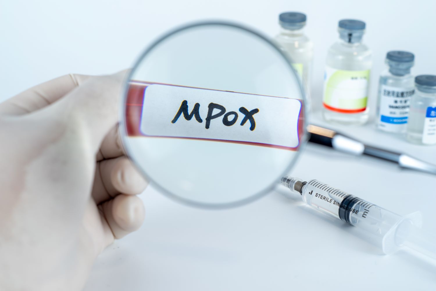 Mpox : l’alerte de portée internationale levée | Egora