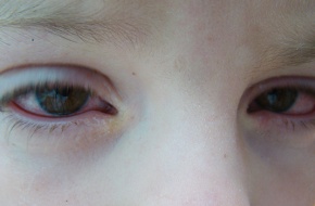 Egora - Actualités médicales - Formation Médicale Continue (FMC ...