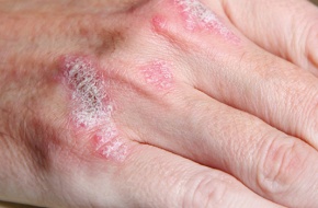 Egora - Actualités médicales - Formation Médicale Continue (FMC ...